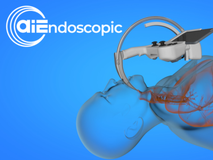 aiEndoscopic closes seed round to boost development of AI-supported ...